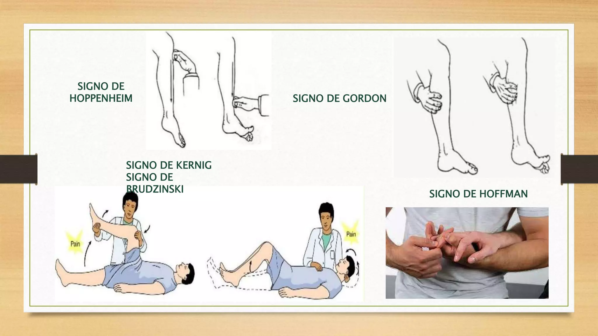 grupo 6 semiologia reflejos osteotendinosos.pptx