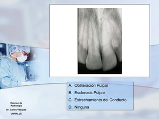 Grupo a | PPT