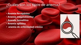 LA ANEMIA | PPTX