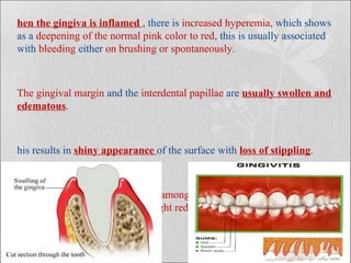5 prevention of periodontal disease | PPT