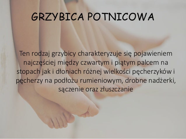 Grzybica stóp