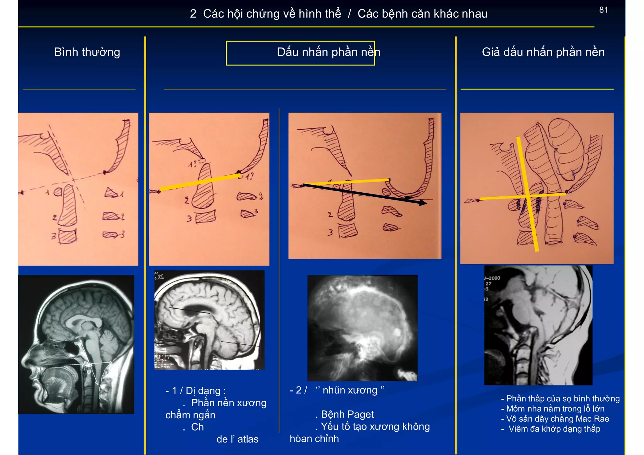 GS Clarisse - 12. Hinh anh ban le so-cot song | PDF