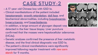 GSD Type 1 biochemistry department science | PPT