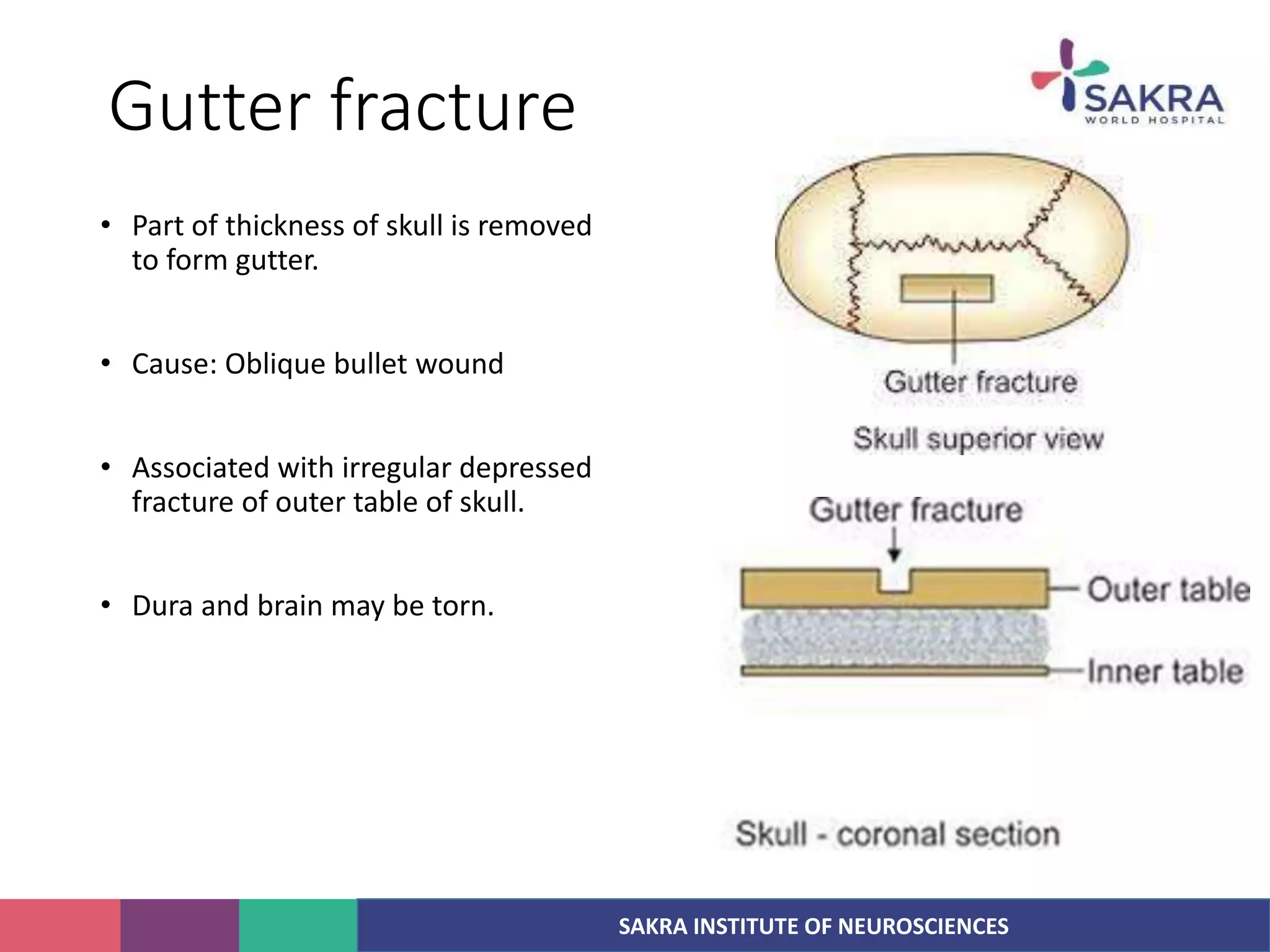 Growing skull fracture | PPTX