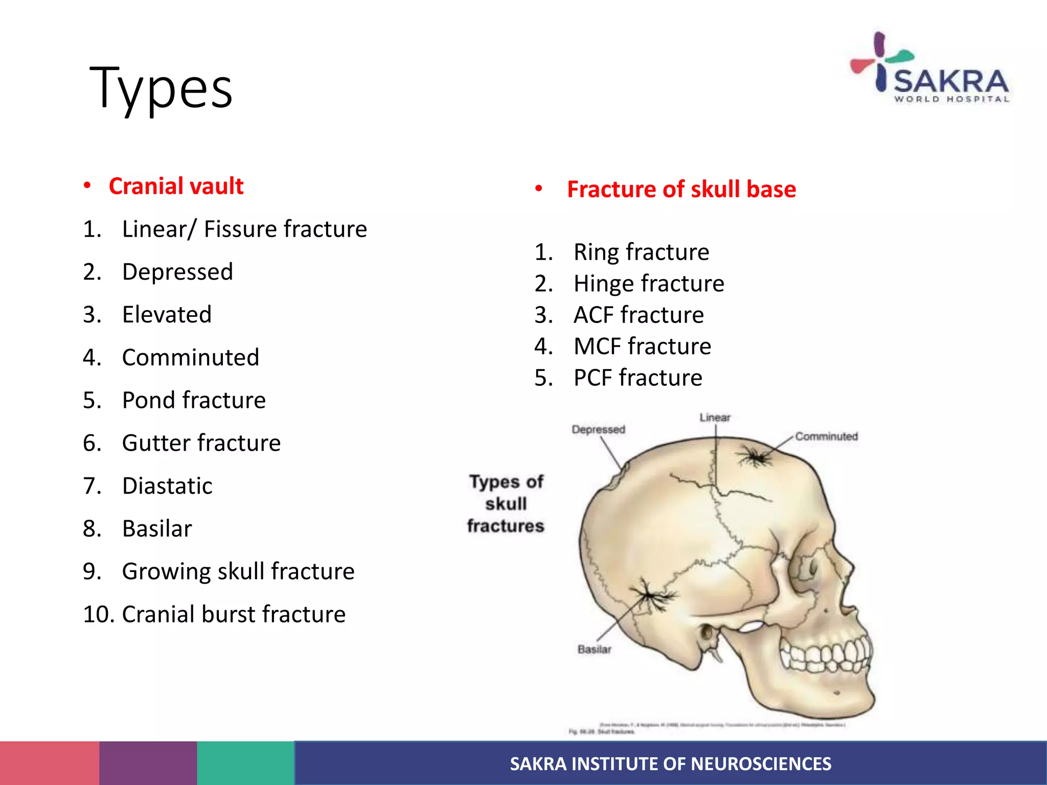 Growing skull fracture | PPTX