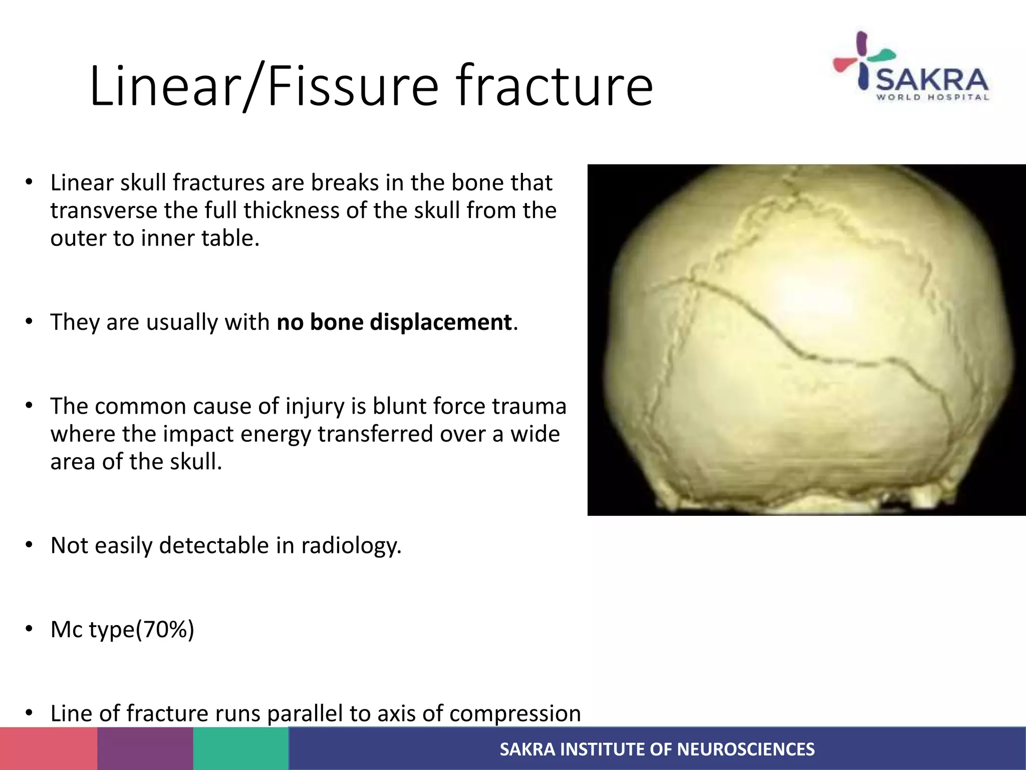 Growing skull fracture | PPTX