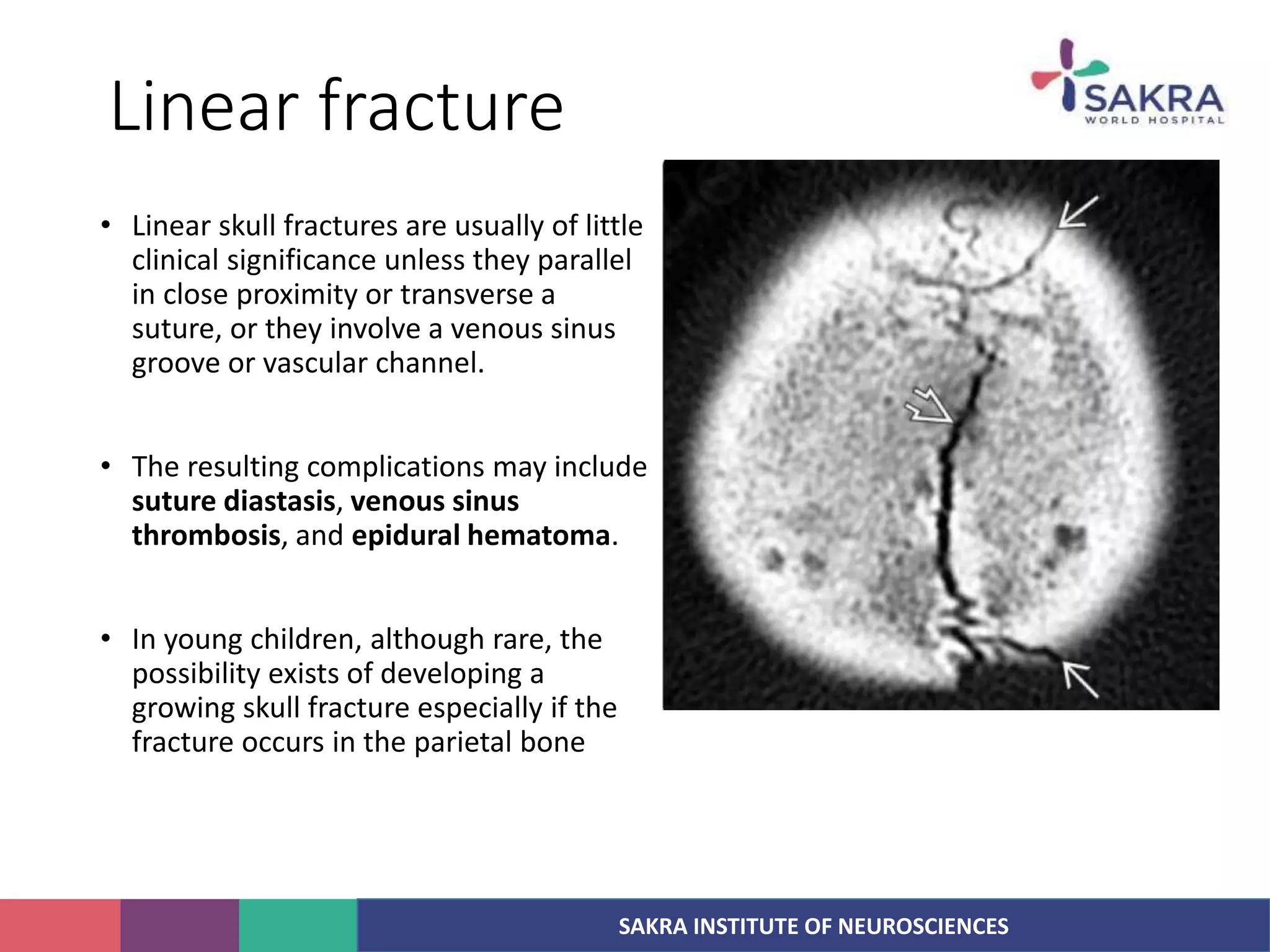 Growing skull fracture | PPTX