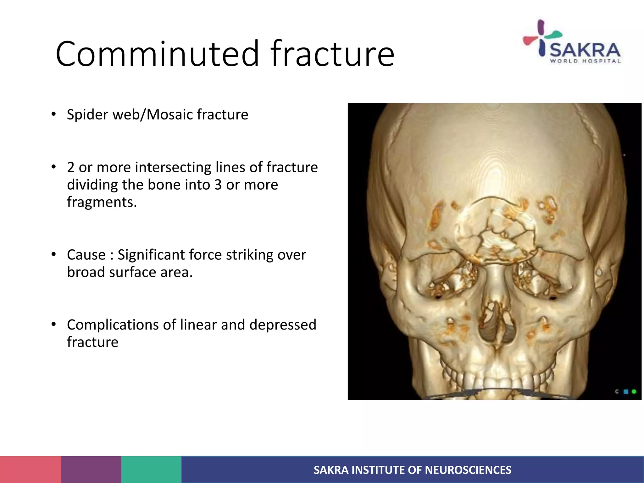 Growing skull fracture | PPTX