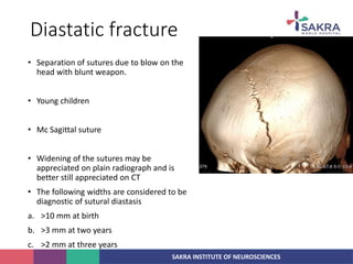 Growing skull fracture | PPTX