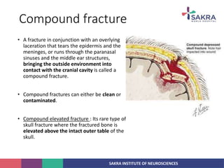 Growing skull fracture | PPTX