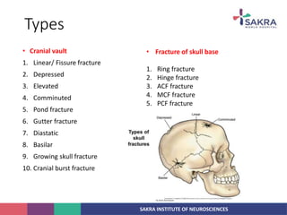 Growing skull fracture | PPTX