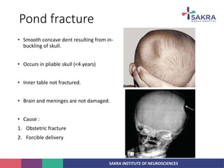 Skull Fracture Calcification