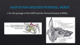 Hiatus Of Facial Canal