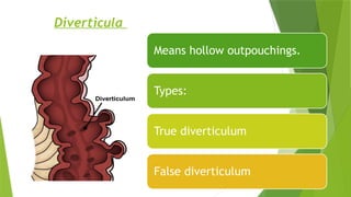 GS ppt final! GASTRIC OUTLET OBSTRUCTION.pptx