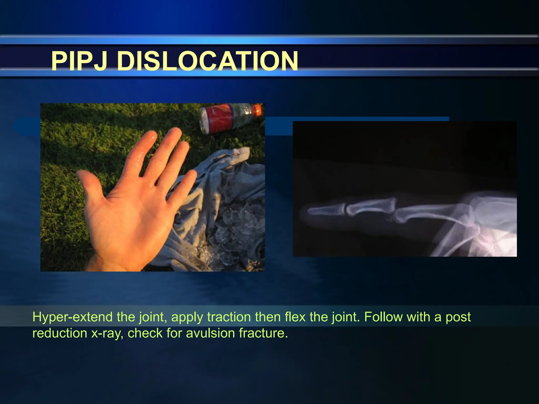 GS_Sem3_2020_Mechanic INJURY.pptxall info | PPT