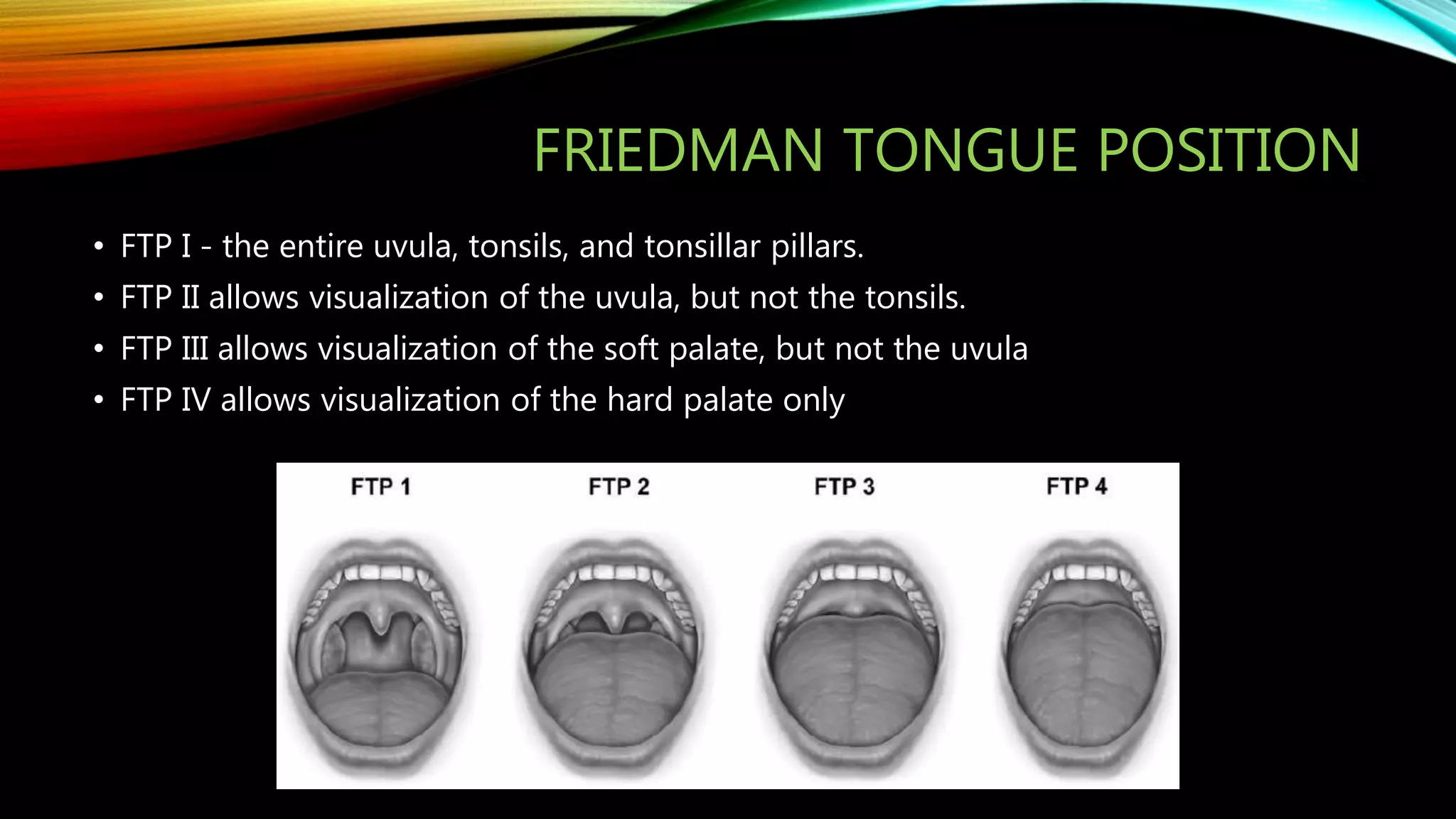 Surgical options for Obstructive sleep apnoea syndrome | PPTX