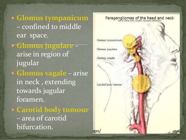 Glomus Tumour and its Approaches