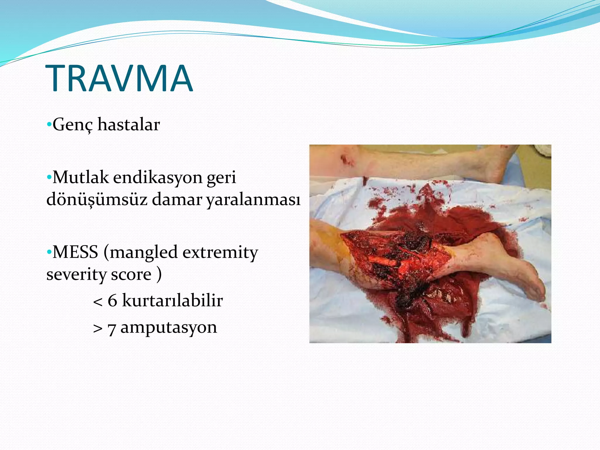 amputasyonlar | PPTX