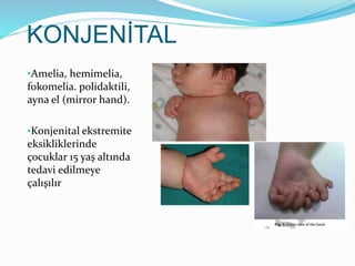 amputasyonlar | PPTX