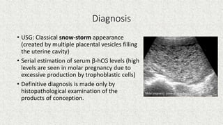Gestational trophoblastic diseases: A review for PG preparation | PPT