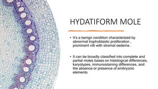 Molar pregnancy .pptx