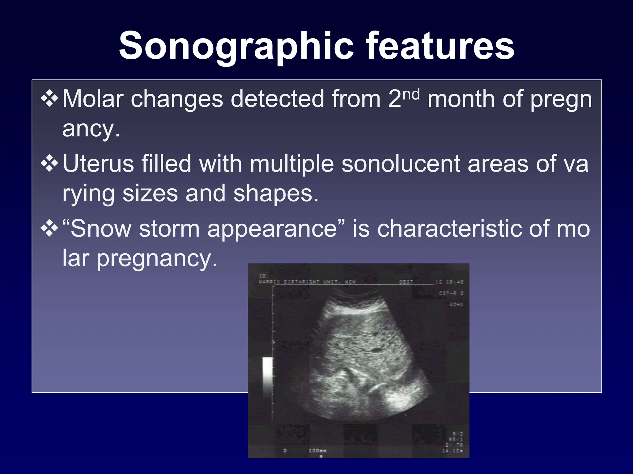 Gestational Trophoblastic Disease - Obstetrics | PPTX