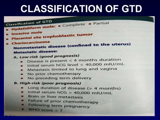 Gestational Trophoblastic Disease - Obstetrics | PPTX