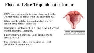 GTDS presentation.pptx gynecology lecture | PPTX