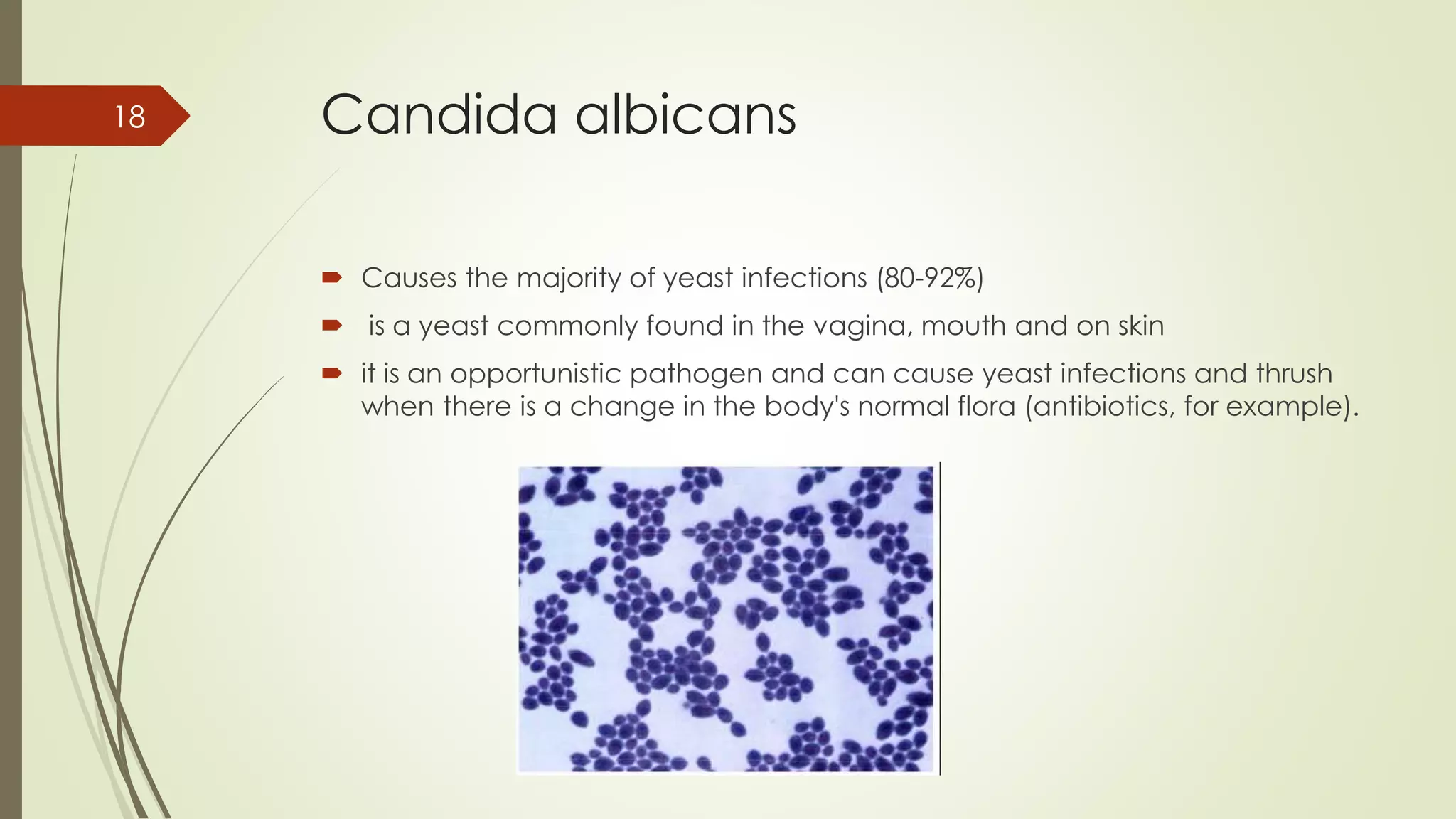 genital infection in gynecology | PPTX