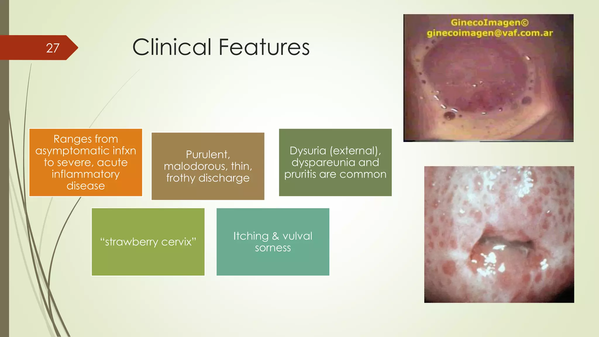 genital infection in gynecology | PPTX
