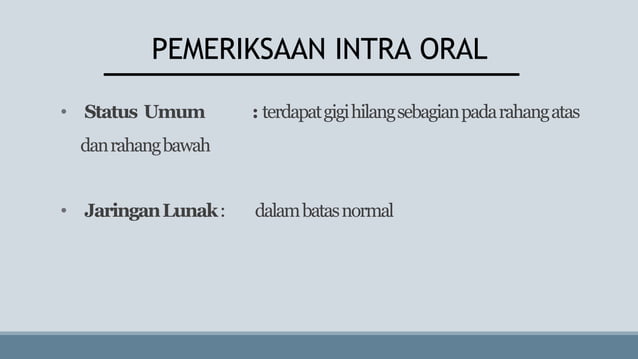 metal frame denture unilateral design using rpa | PPTX