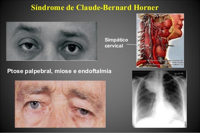 Síndromes respiratórias