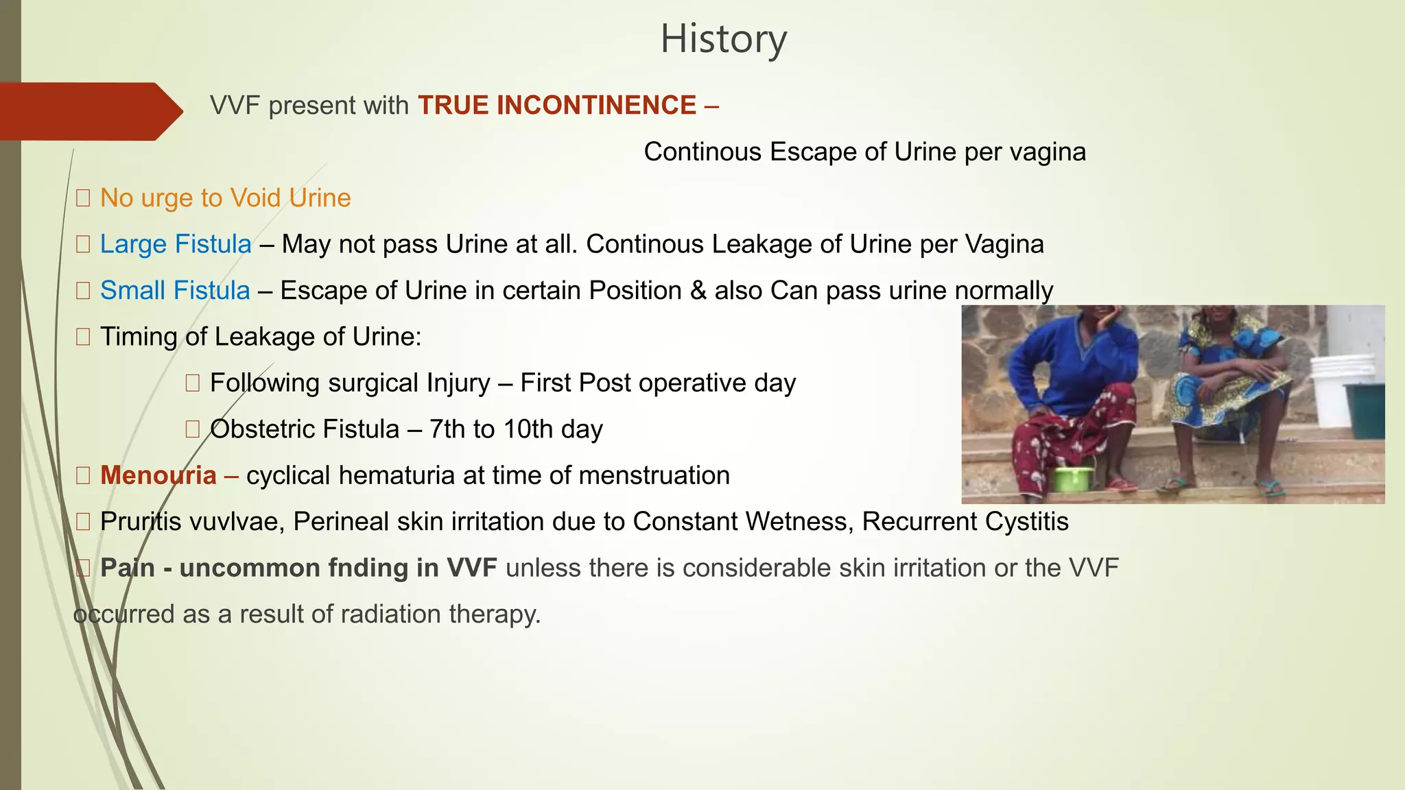 urinary tract fistula | PPTX
