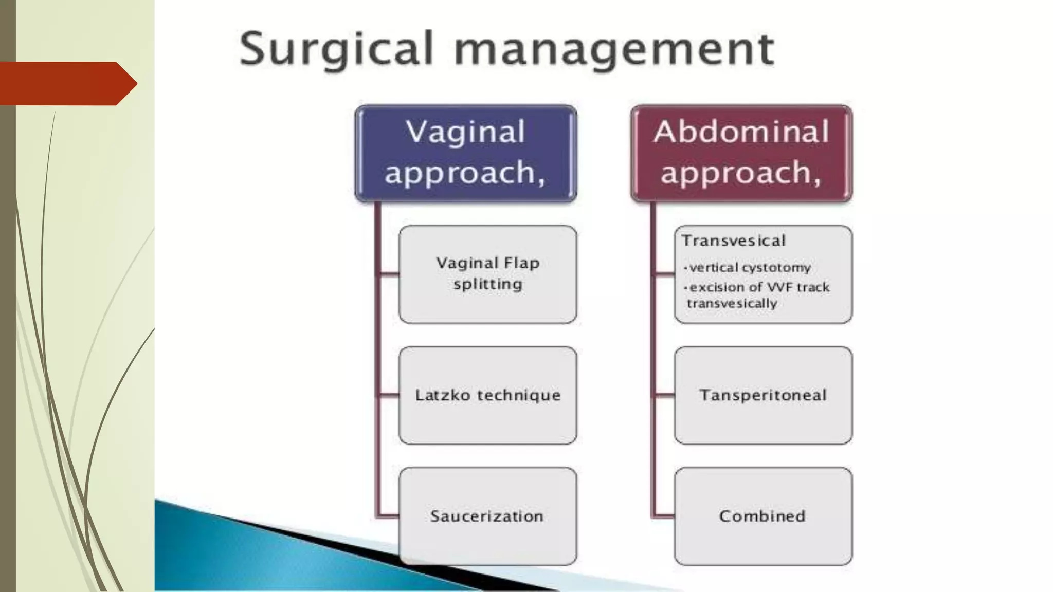urinary tract fistula | PPTX