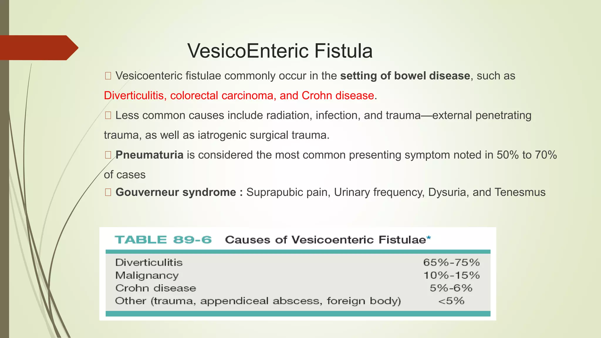 urinary tract fistula | PPTX