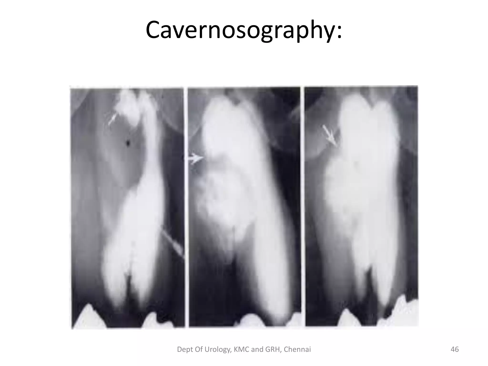 Gu trauma- external genitalia | PDF