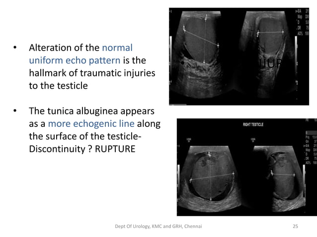 Gu trauma- external genitalia | PDF