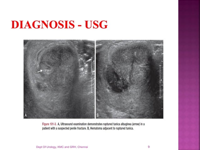 Gu trauma- genital | PDF