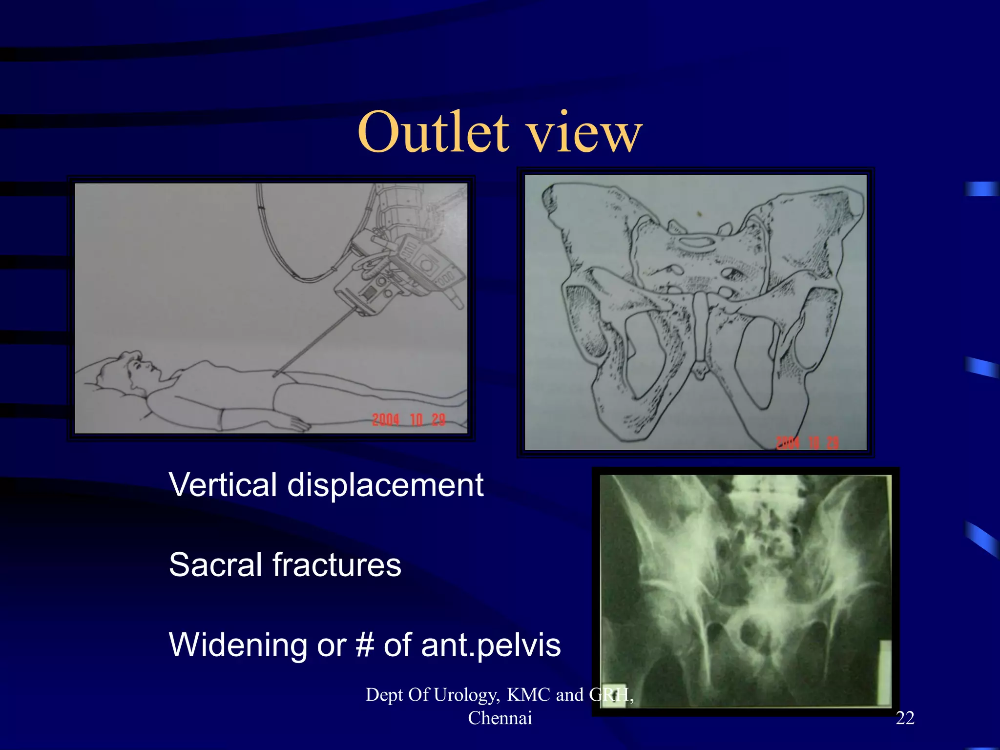 Gu trauma- ortho trauma | PDF