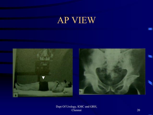 Gu trauma- ortho trauma | PDF | Death, Injury, or Military Conflict ...