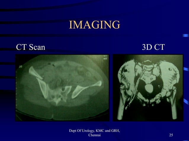 Gu trauma- ortho trauma | PDF | Death, Injury, or Military Conflict ...