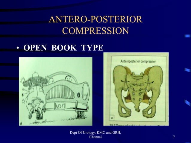 Gu trauma- ortho trauma | PDF | Death, Injury, or Military Conflict ...