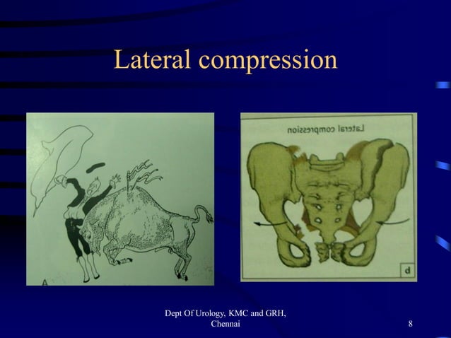 Gu trauma- ortho trauma | PDF | Death, Injury, or Military Conflict ...