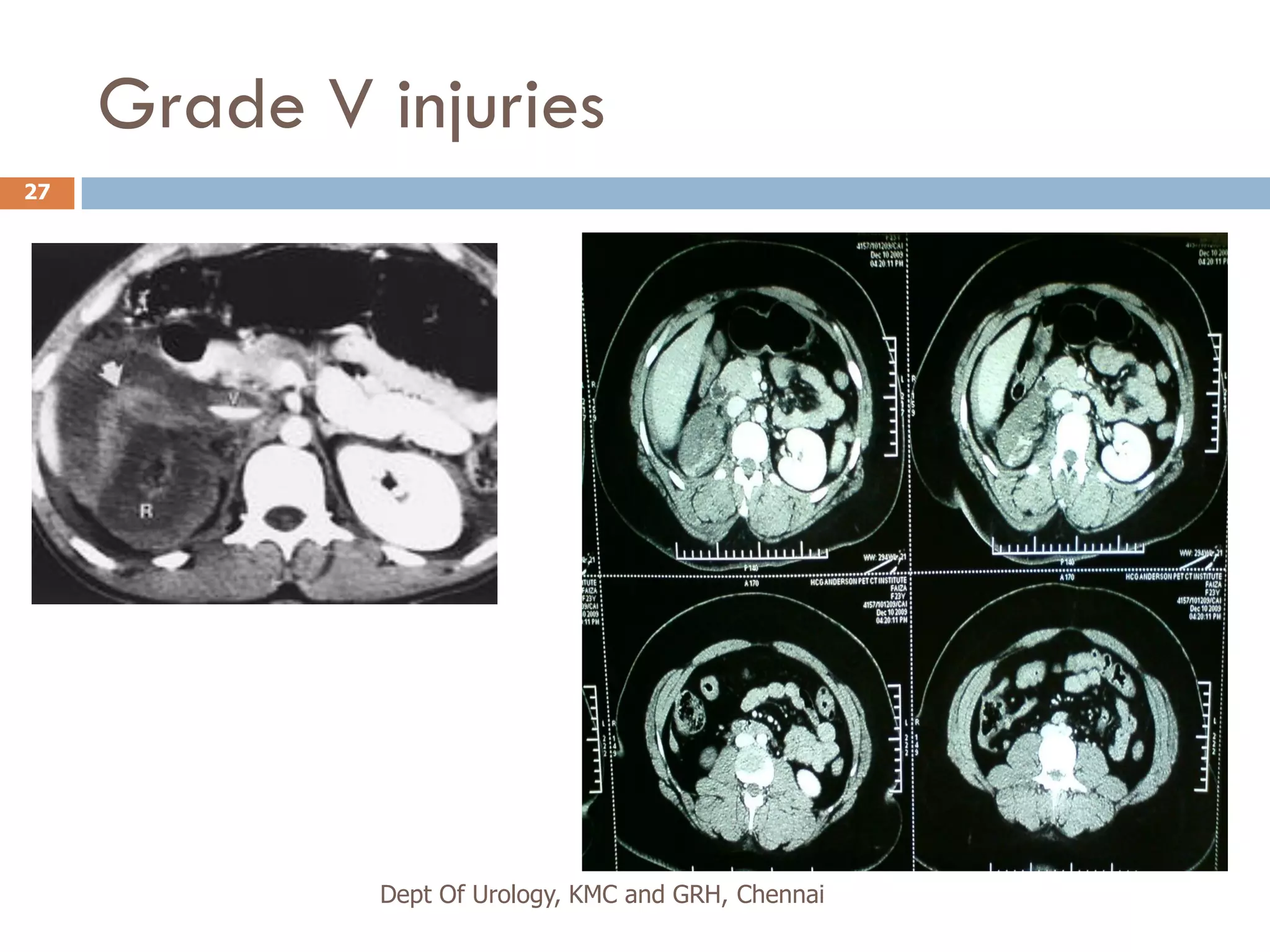 Gu trauma- renal 1 | PPT | Free Download