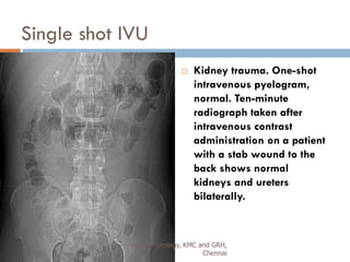 Gu trauma- renal 1 | PDF