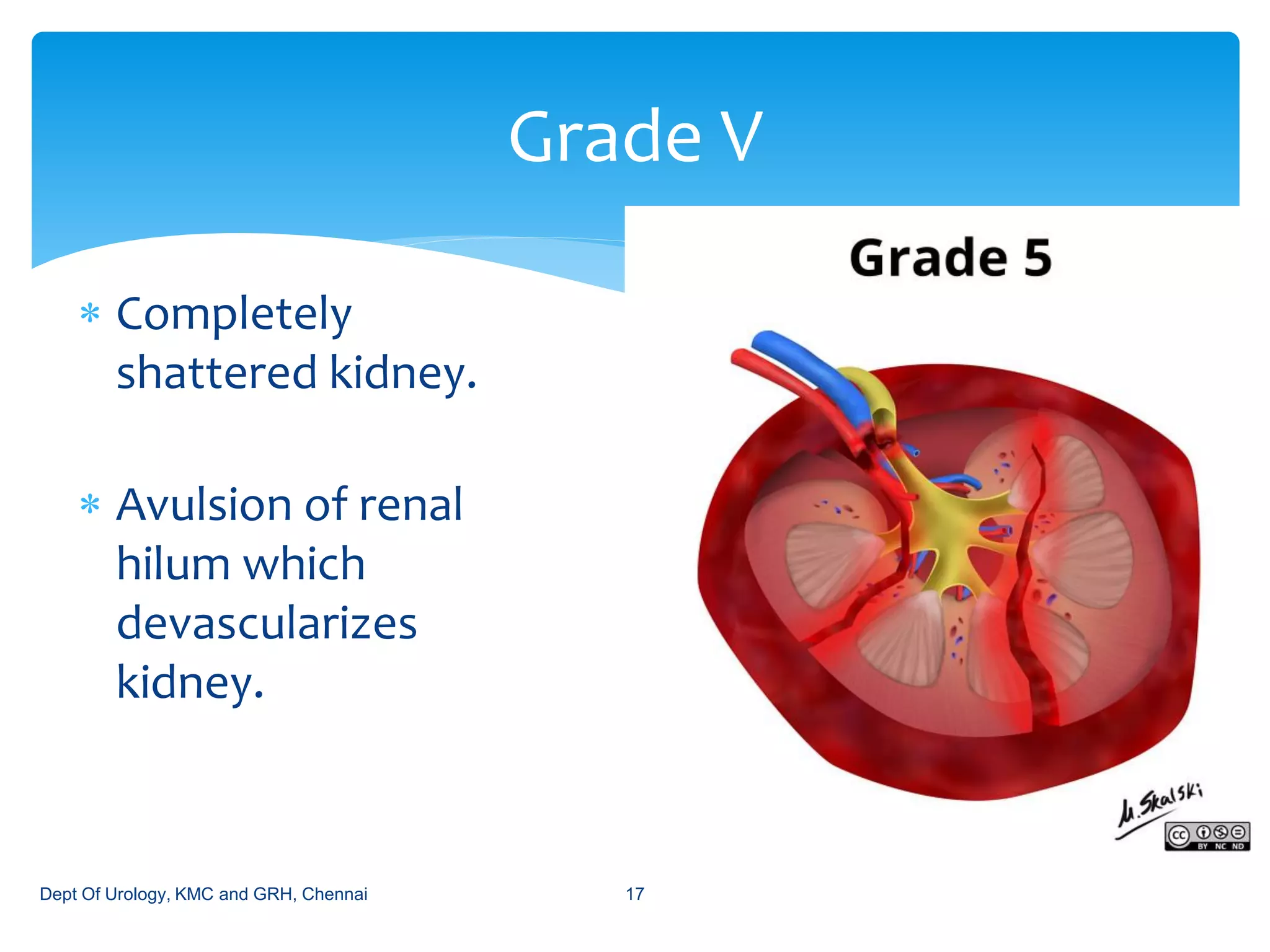 Gu trauma- renal 2 | PDF