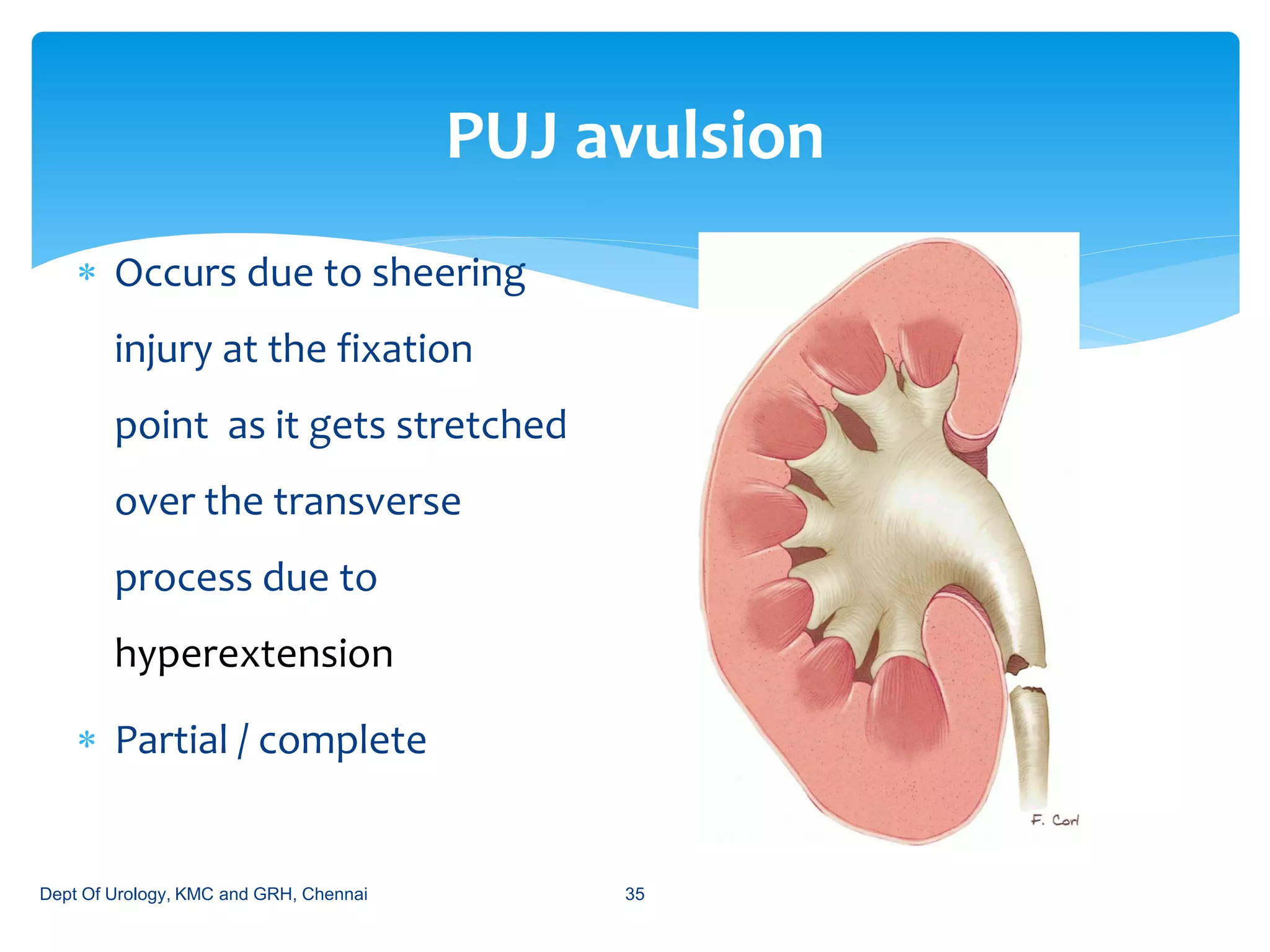 Gu trauma- renal 2 | PDF