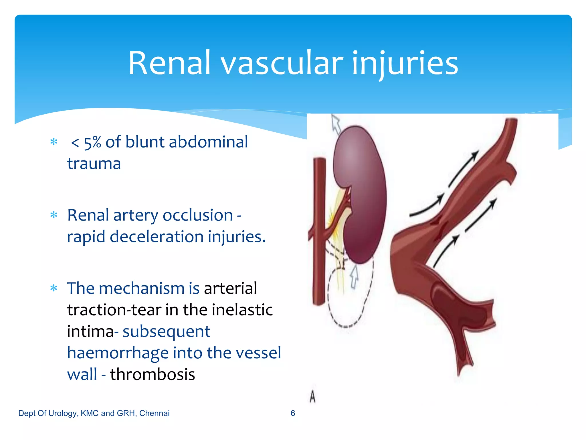 Gu trauma- renal 2 | PDF