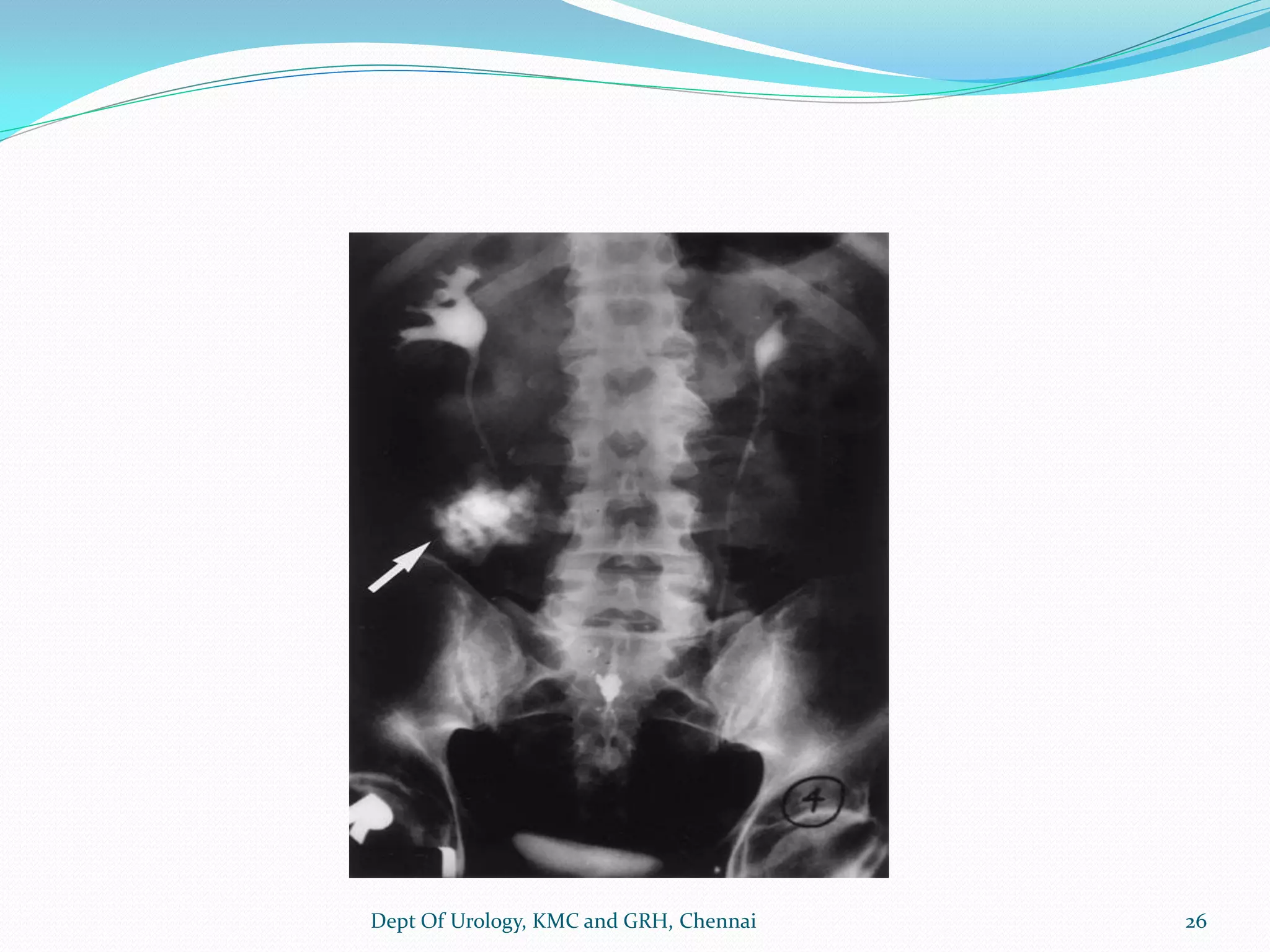 Gu trauma- ureter | PDF | Death, Injury, or Military Conflict ...