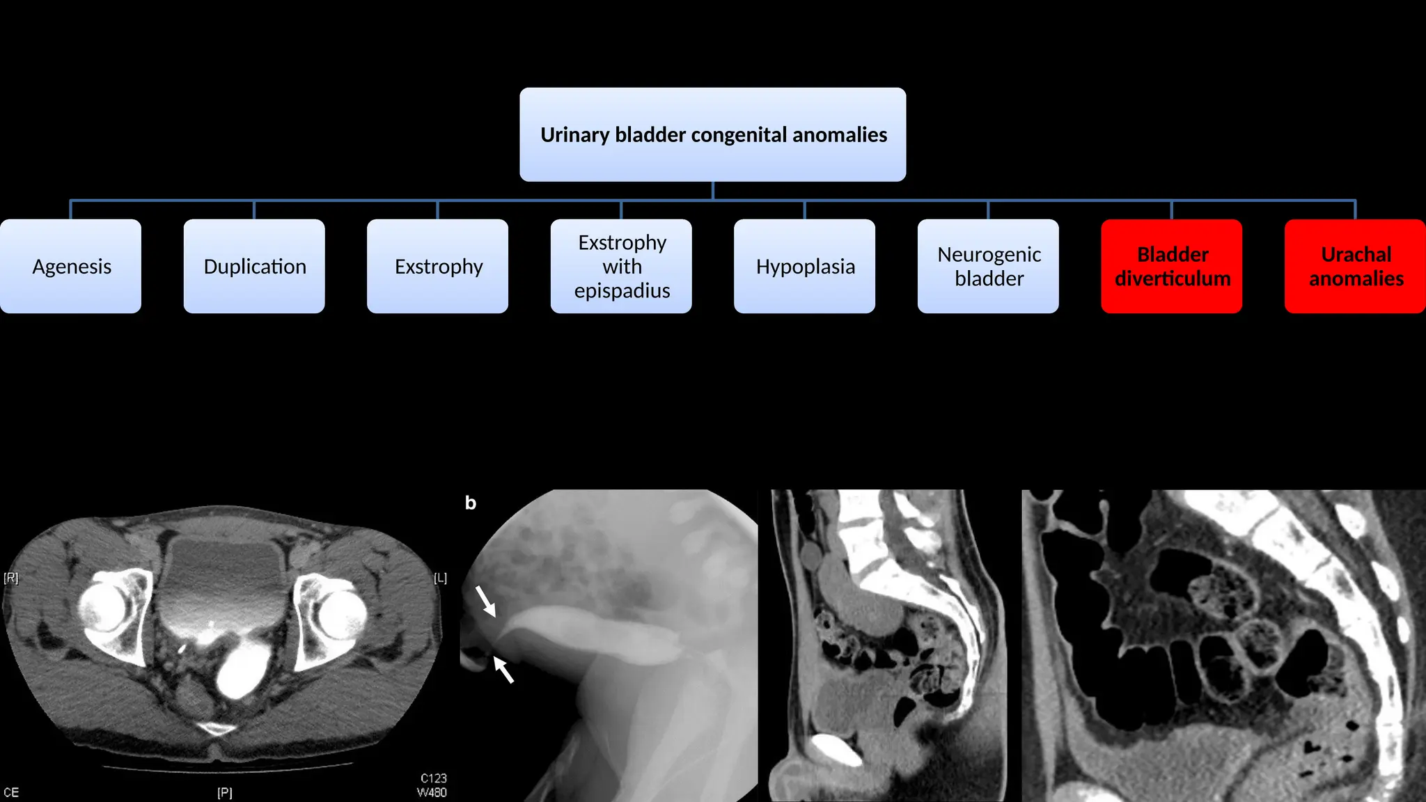 GU radiology part 4 .pptx cases and items | PPT